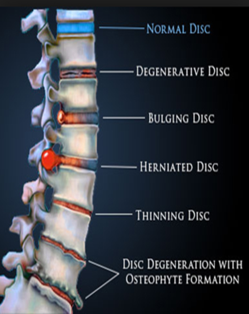 Module 2 – Anatomy & The Back – Darren Whelan